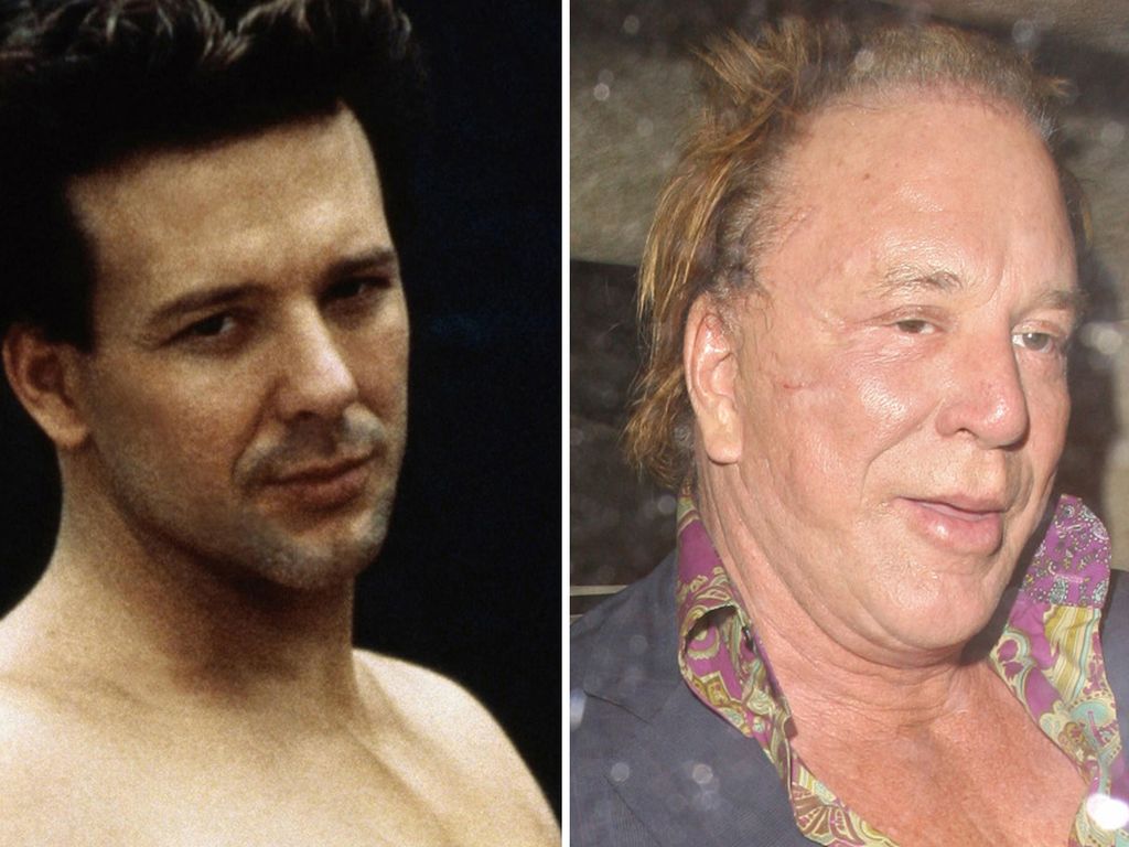 Mickey Rourke: Vom Beau zum Beauty-OP-Opfer | Promiflash.de