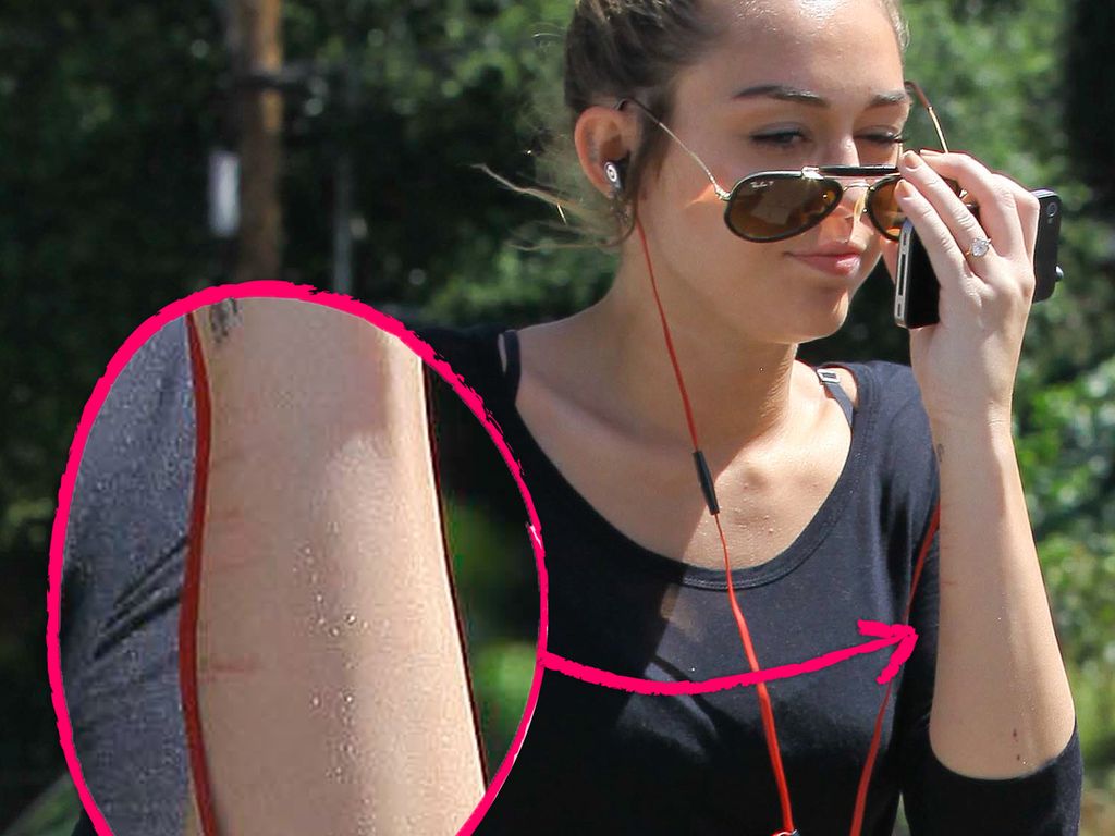 Krasse Narben! Verletzt sich Miley Cyrus selbst? | Promiflash.de