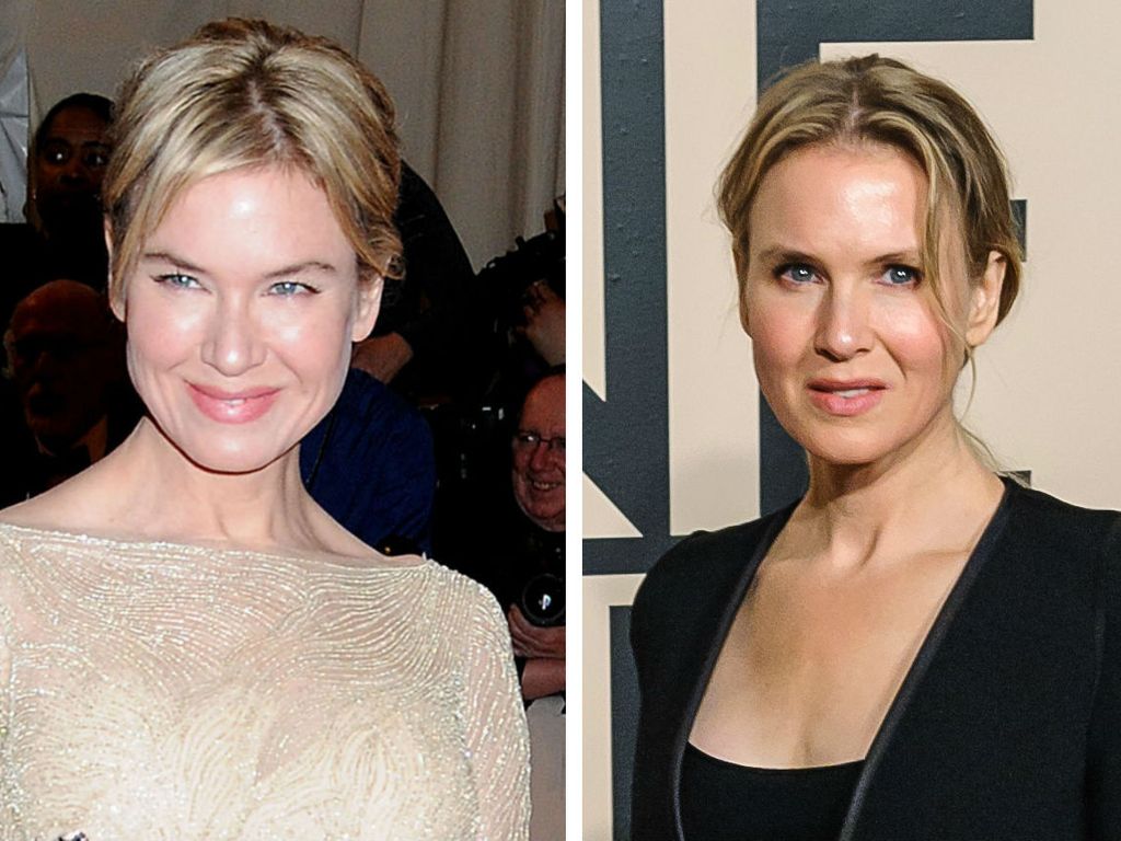 Schönheitswahn? DAS ist die neue Renee Zellweger | Promiflash.de