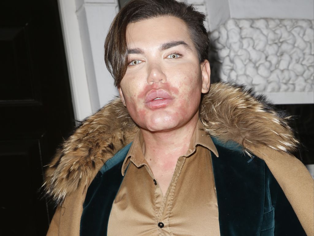 Was ist denn da passiert? Real-Life-Ken mit bösem Ausschlag ...