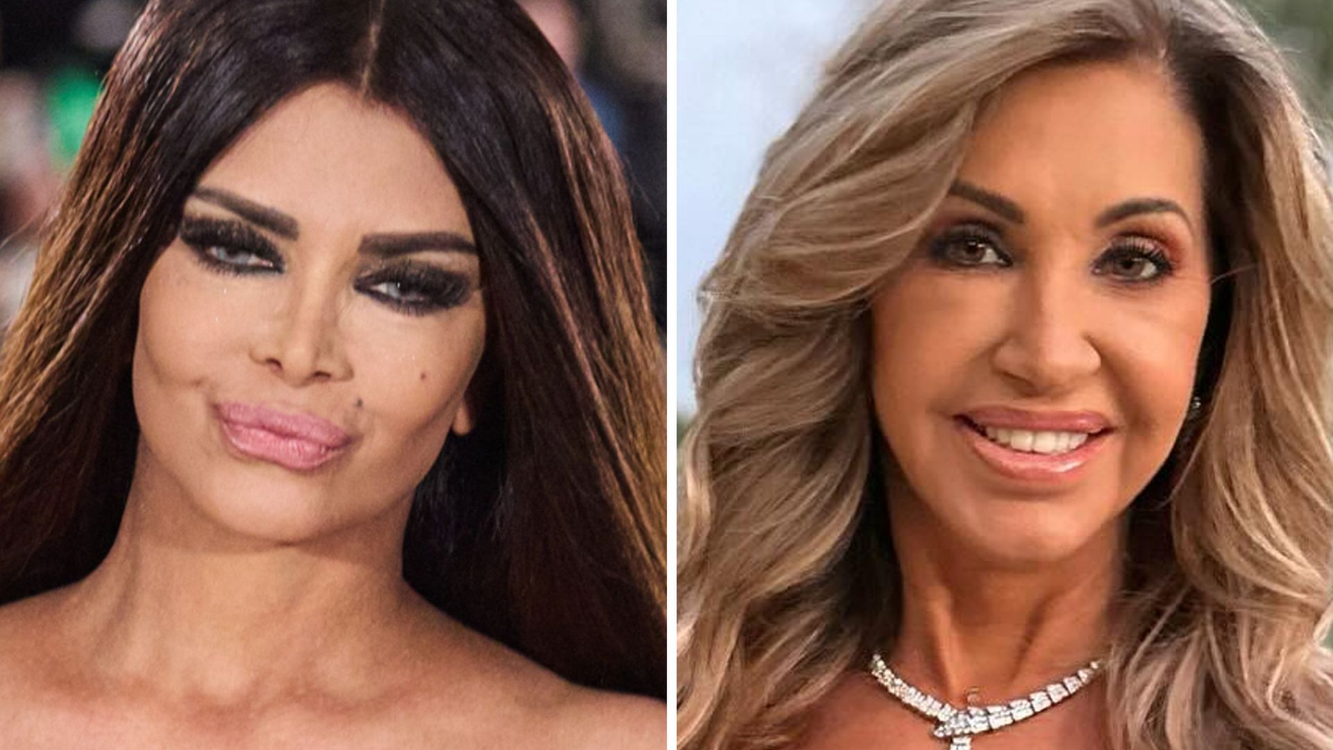 Teure Schönheits-OP: Kader Loth schießt gegen Carmen Geiss