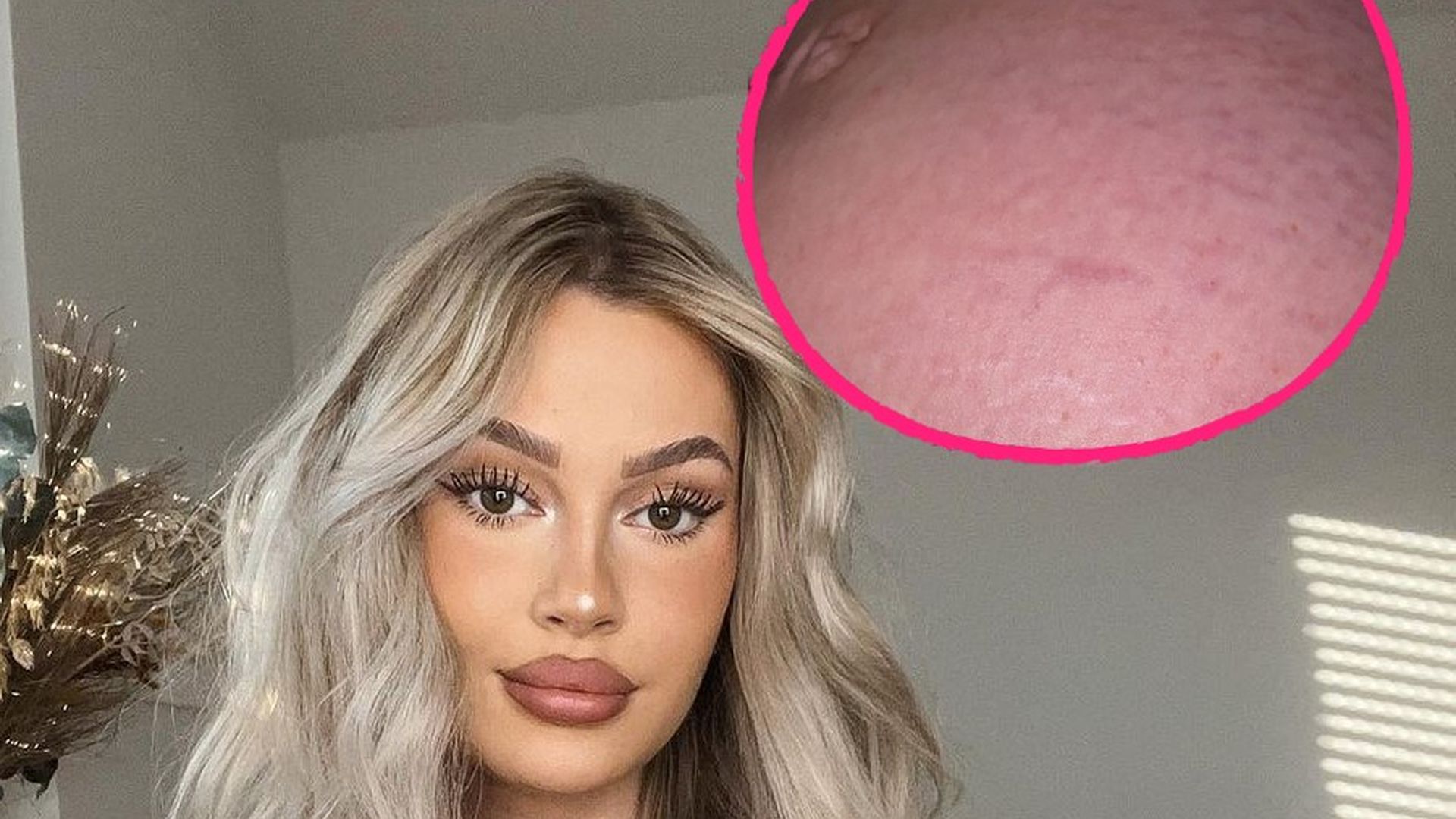 Wochen vor Geburt: Denise Mskis Bauch ist "unten gerissen"