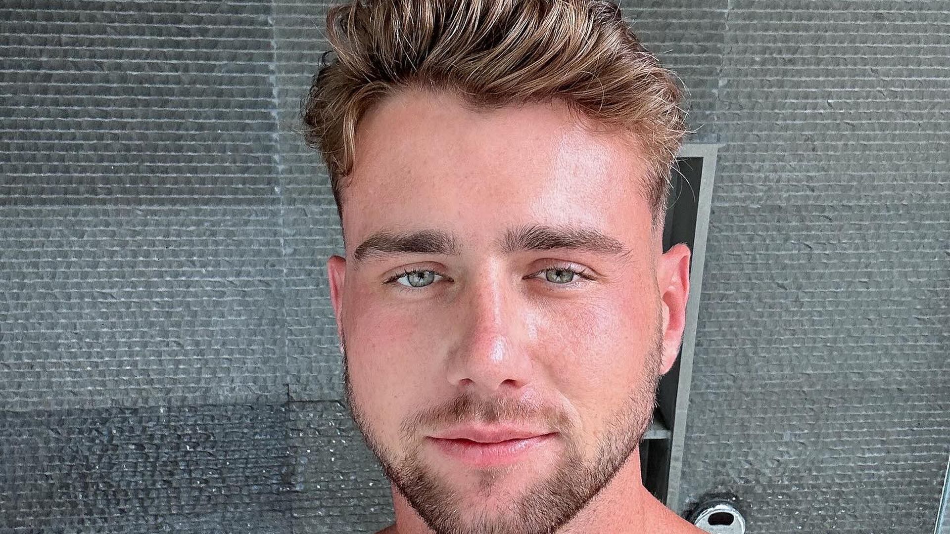 Harry Jowsey zieht Positives aus seiner Hautkrebs-Diagnose