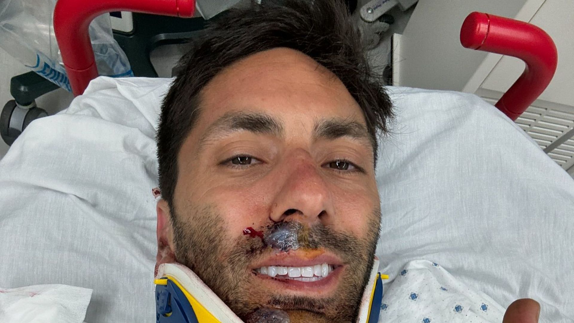 Von Lastwagen erfasst: Nev Schulman brach sich das Genick