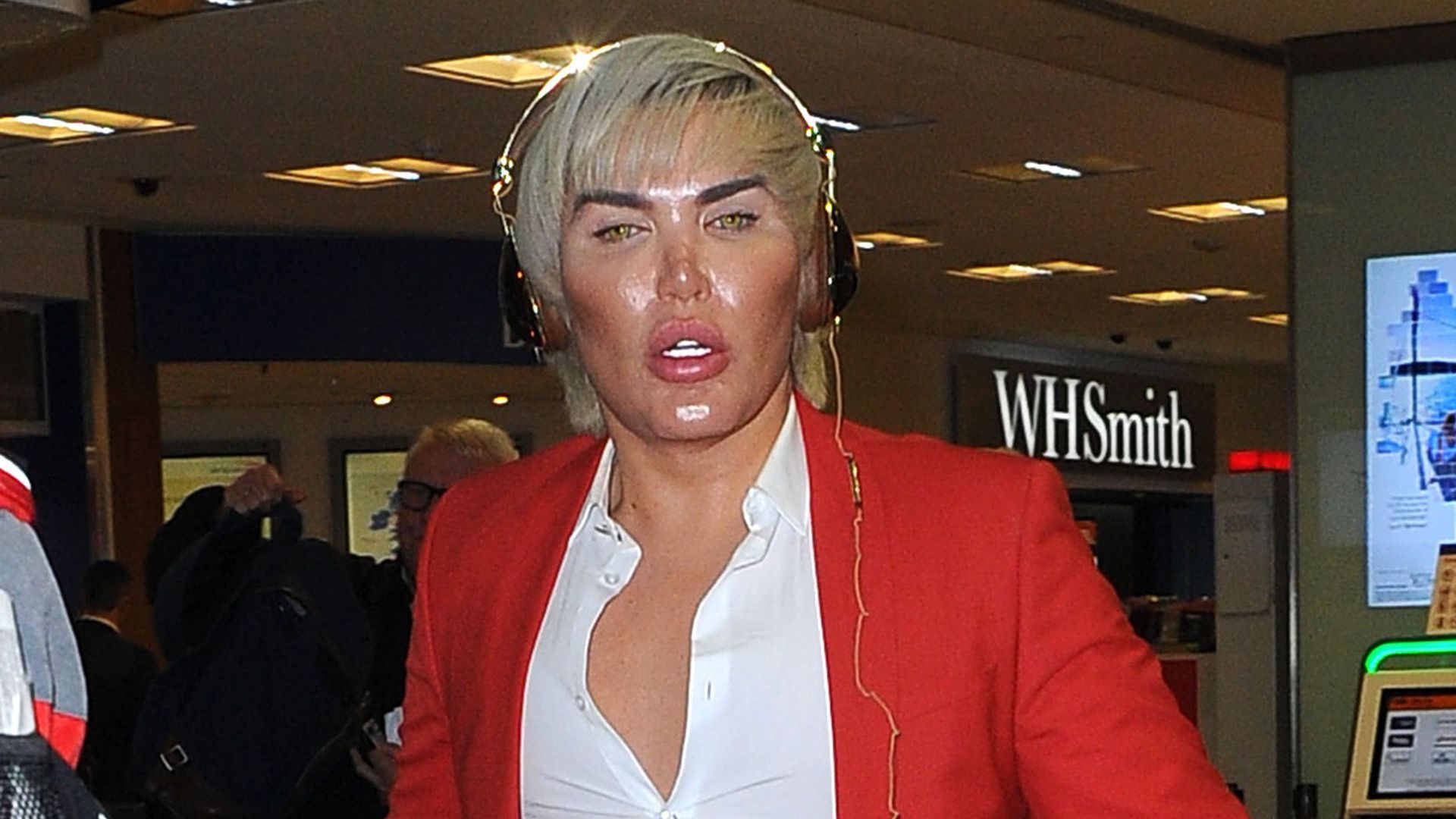 OP-Wunder Rodrigo Alves: Image als "Real-Life-Ken" nervt ihn ...