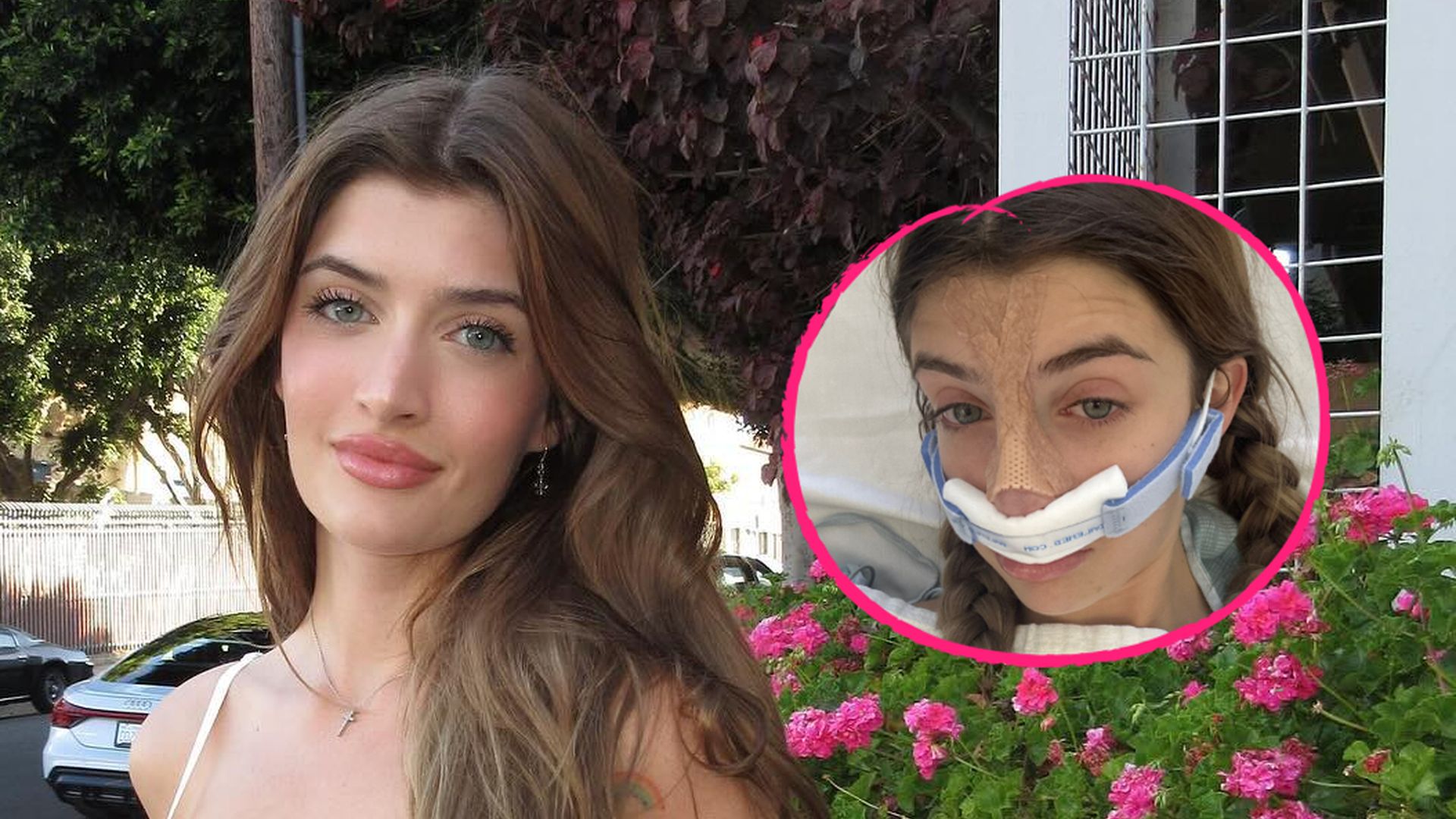 "Zu groß": Charlie Sheens Tochter Sami hatte Nasenoperation