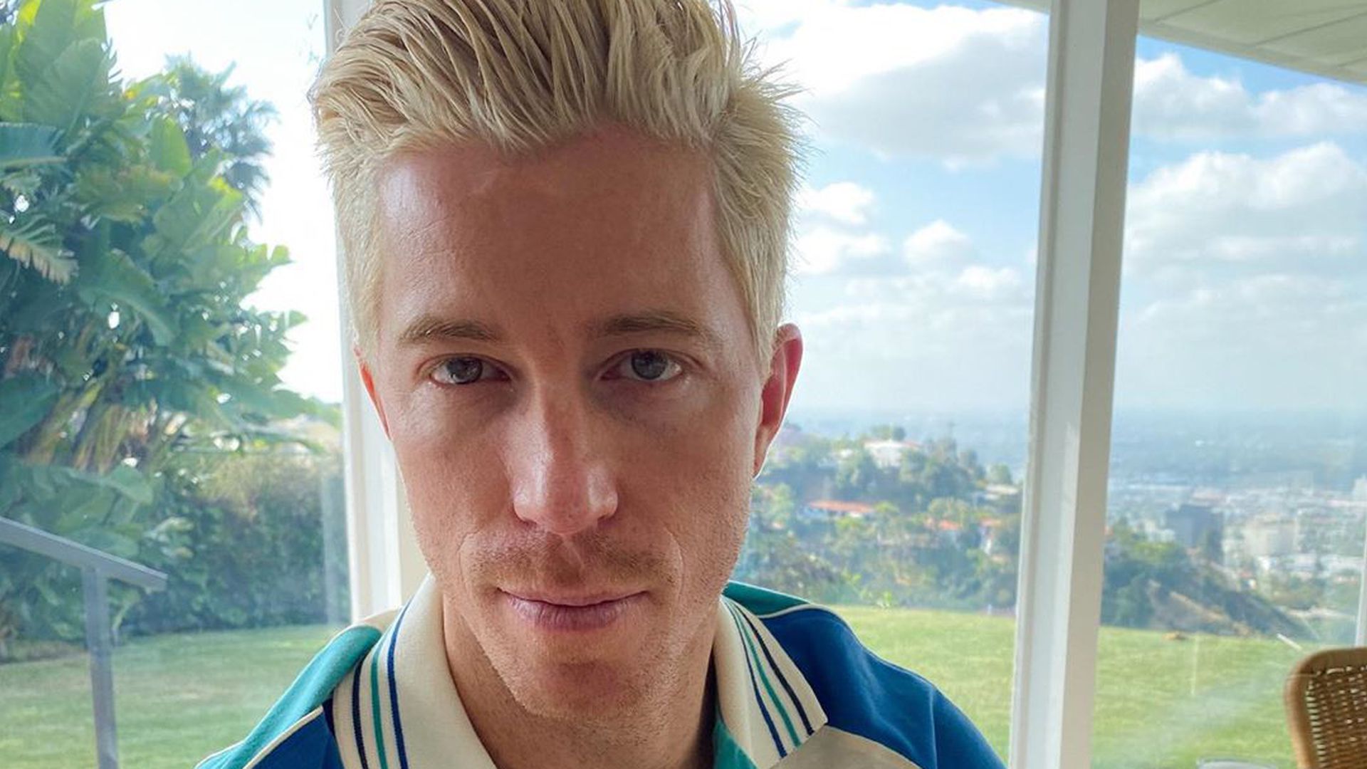 Ungewohnt: Shaun White zeigt sich mit blonder Haarpracht!