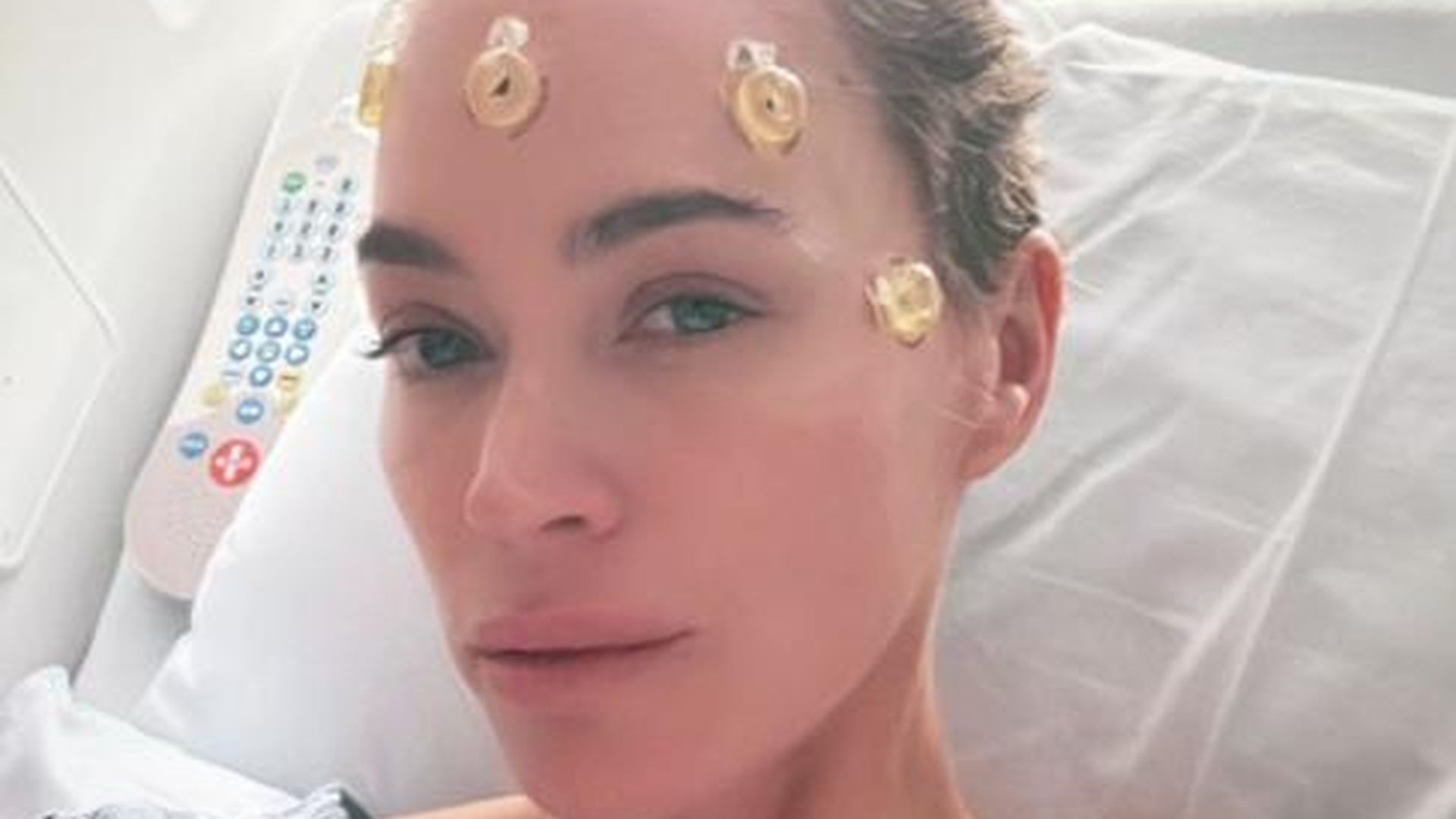 Teddi Mellencamp wird nach Hirn-OP von Ex Edwin unterstützt