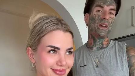 Influencer Justin Bunyai verliert bei Sturz den rechten Arm