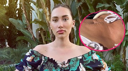 Nach Brustkrebs: Olivia Munn entdeckt neue Lebensfreude